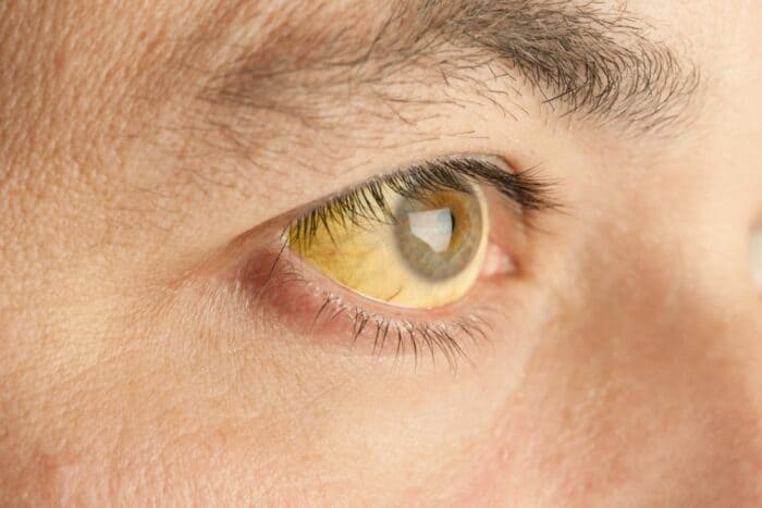 Costa Rica's New Yellow Fever Certificate Requirements for ...