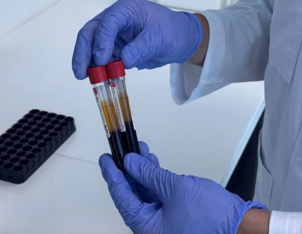 Costa Rica to Introduce Advanced Blood Test for Early Detection of Cancer
